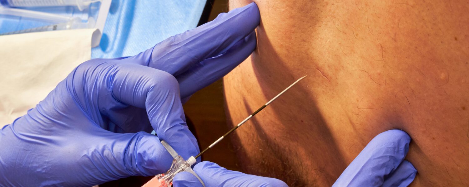 Epidural Injection for Chronic Pain Relief - St Hugh’s